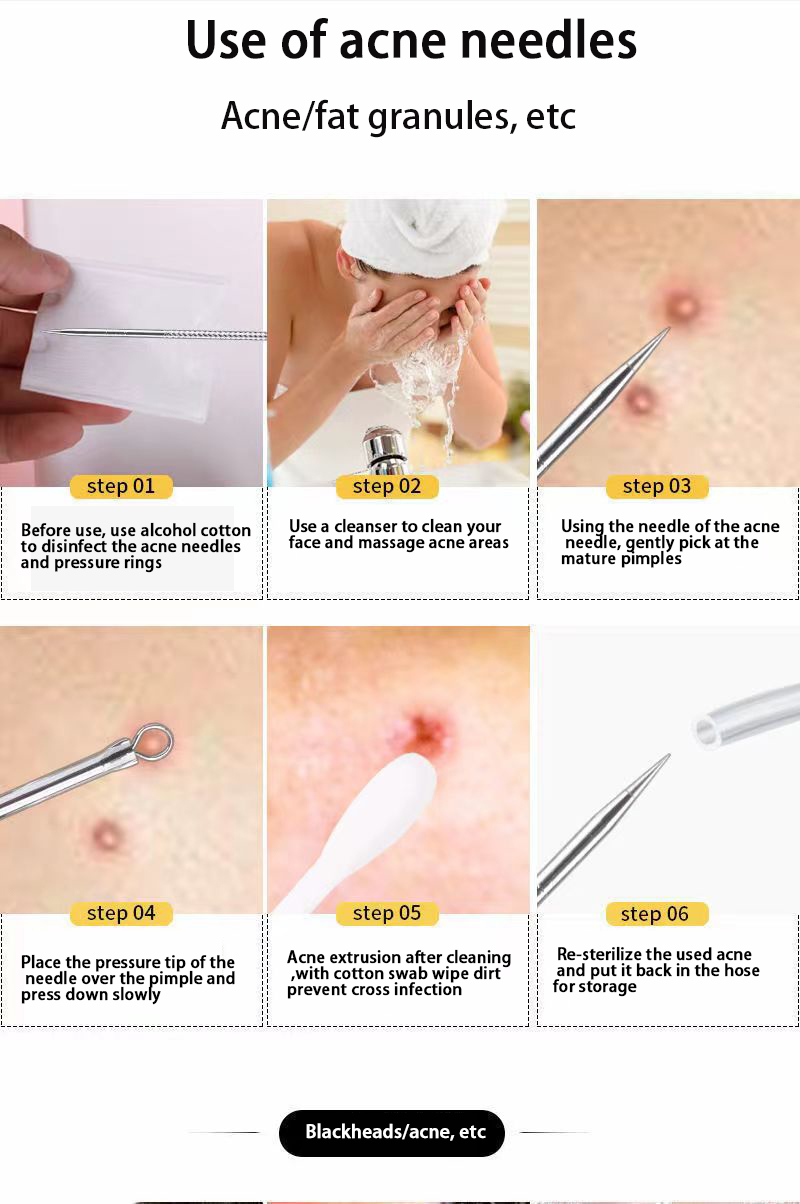 5pcs/Set Stainless Steel Acne Clip Acne Blackhead Needle | Shopee ...