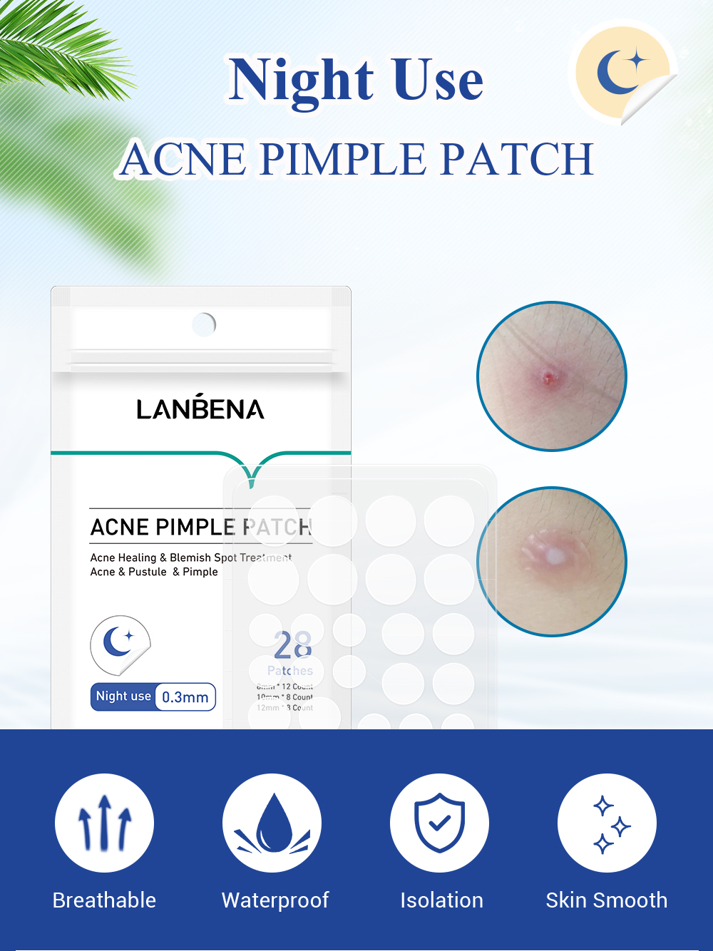 LANBENA Acne Patch Pimple Treatment Night Use Acne Removal in 12H Acne ...