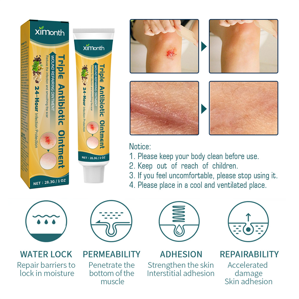 XIMONTH Triple Antibiotic Ointment 28.3g Skin Therapy Healing Cream ...