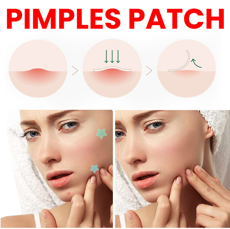 200Pcs Hydrocolloid Acne Patches With Witch Hazel & Hyaluronic Acid ...