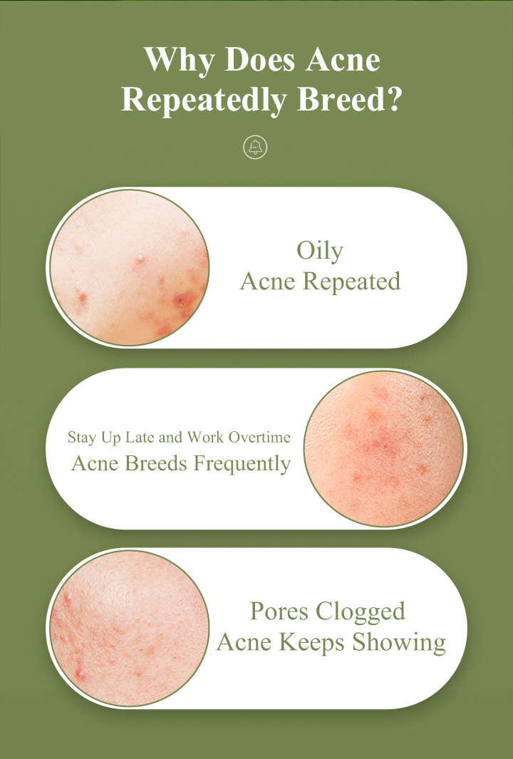 BREYLEE Tea Tree Acne Treatment Gel Acne Remover Gel Pimple Marks ...