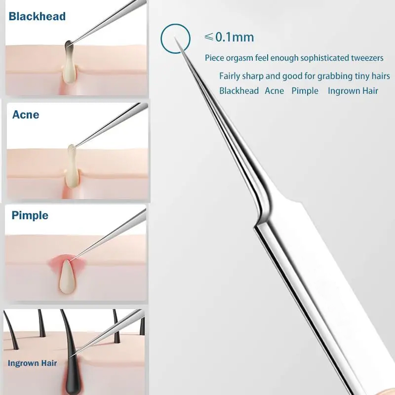 5pcs/Set Stainless Steel Acne Clip Acne Blackhead Needle | Shopee ...
