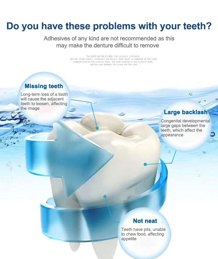 Dental Filling Gel DM denture glue dental denture adhesive Quick Repair ...