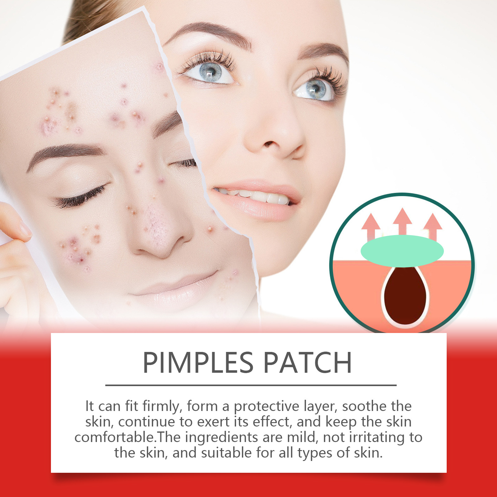 600PCS Pimple Patches for Face, Hydrocolloid Acne Patches, Zit Patches ...