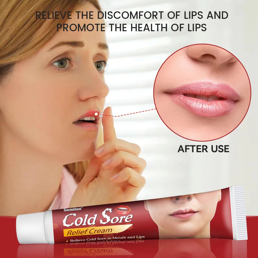20g Cold Sore Relief Cream Cheilitis Lips Relief Cream Repair lip Dry ...