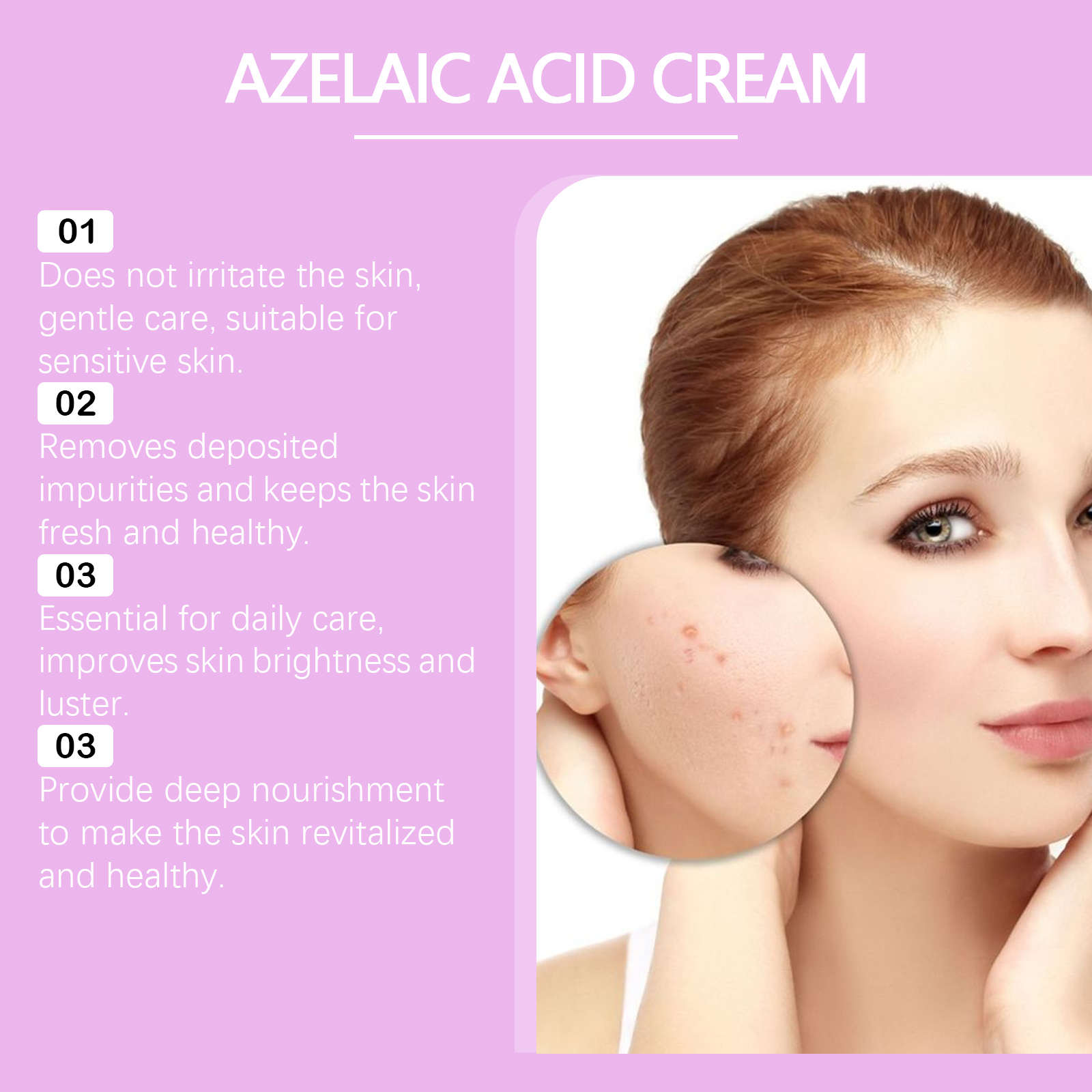 OUHOE Salicylic Acne Repair Cream For Face 20g Remove Blackhead ...