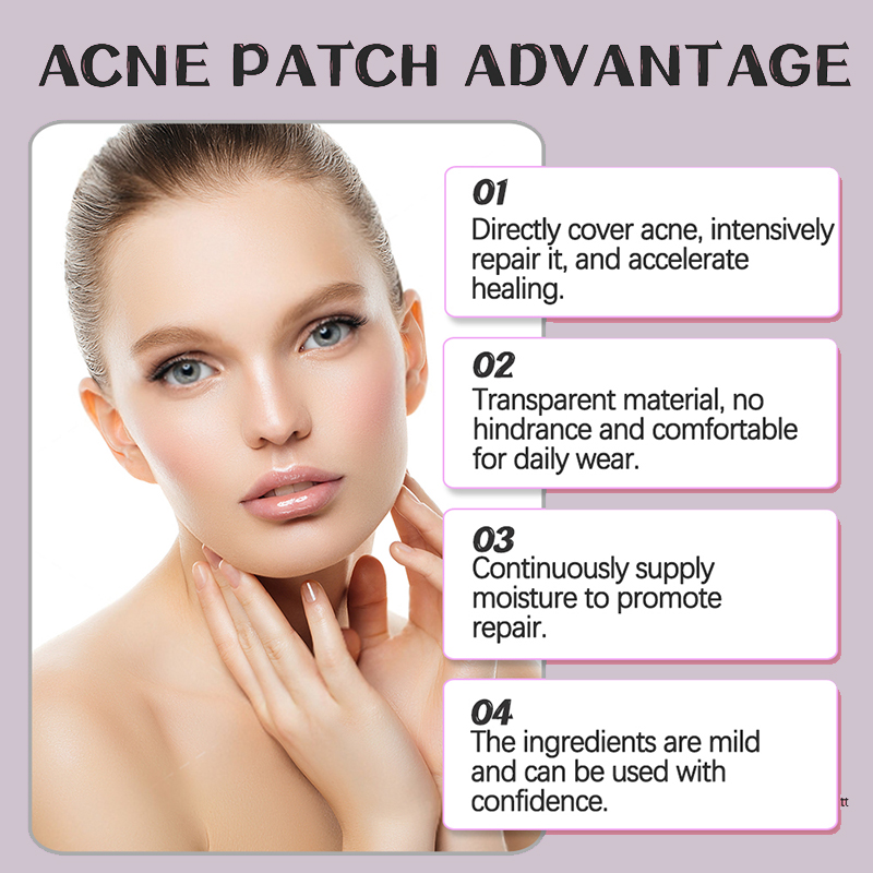 Acne Pimple Patches for Face, Hydrocolloid Acne Patches for Covering ...