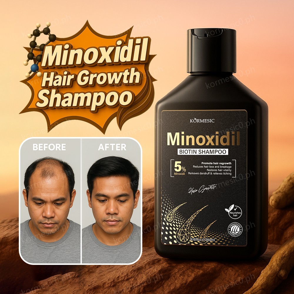 KORMESIC 5% Minoxidil+Biotin Shampoo 260ml - DHT Blocker Anti-Hairloss ...