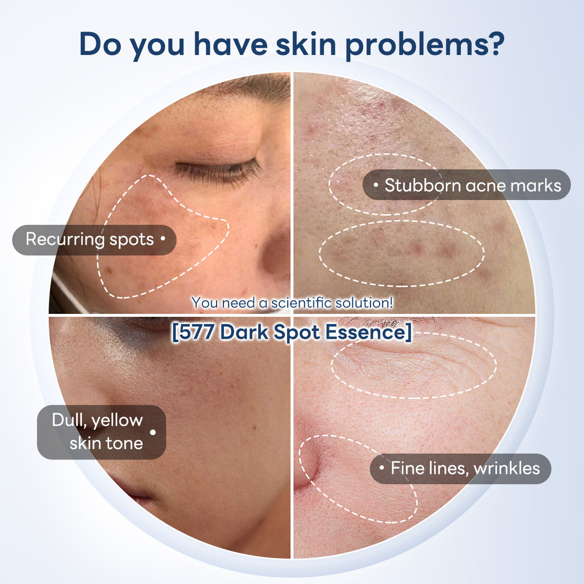 PAPA FEEL【Skin Care Set】577 Fade Dark Spot Serum 30ml + Skin Barrier ...