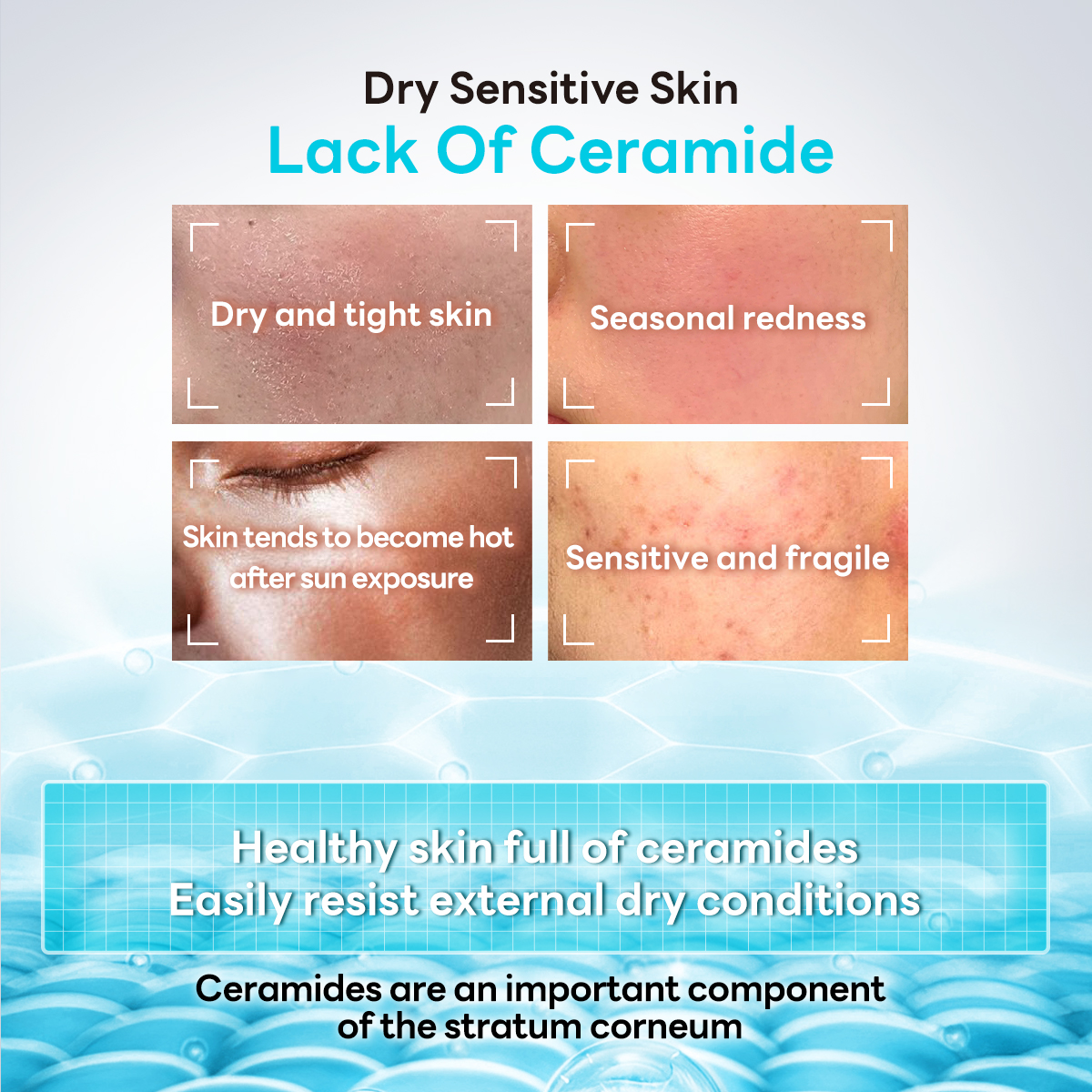 PAPA FEEL【Skin Care Set】577 Fade Dark Spot Serum 30ml + Skin Barrier ...