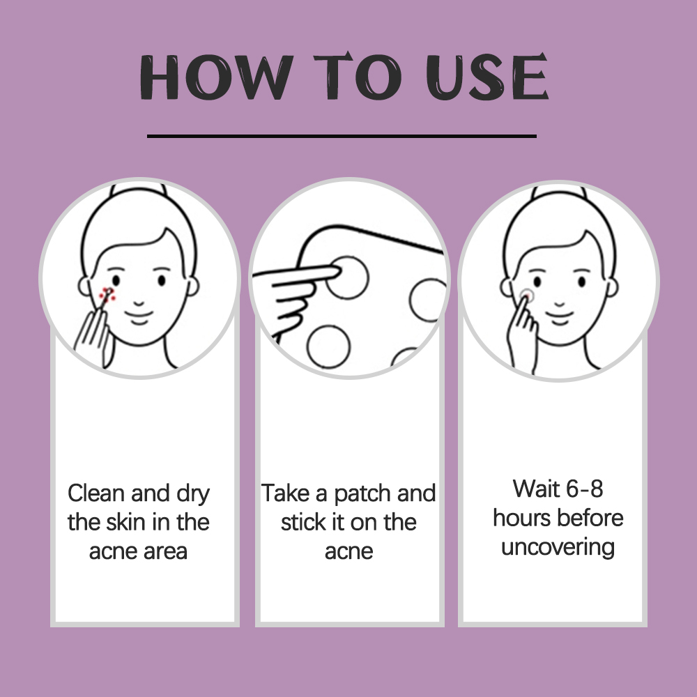 200PCS Pimple Patches For Face, Hydrocolloid Acne Patches, Cute Star ...