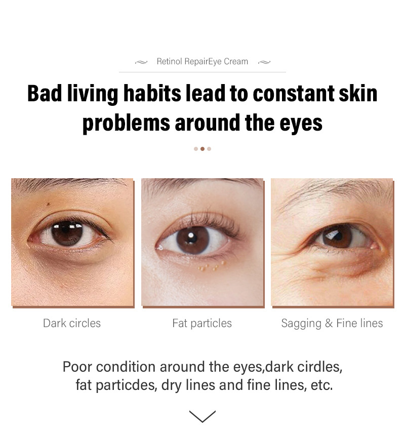 MoIka Retinol Eye Cream Effectively removes eye bags dark circles ...