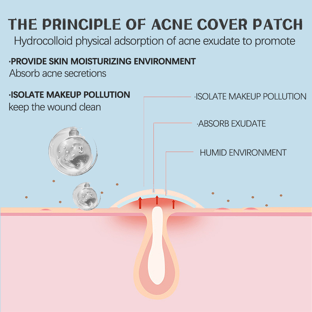 XMAS Gift Skincare Essential ,40pcs Hydrocolloid Acne Patches - Face ...