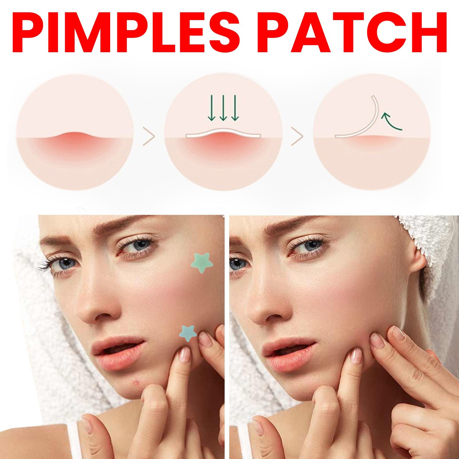 200pcs Star Pimple Patch Acne Colorful Invisible Acne Removal Skin Care ...