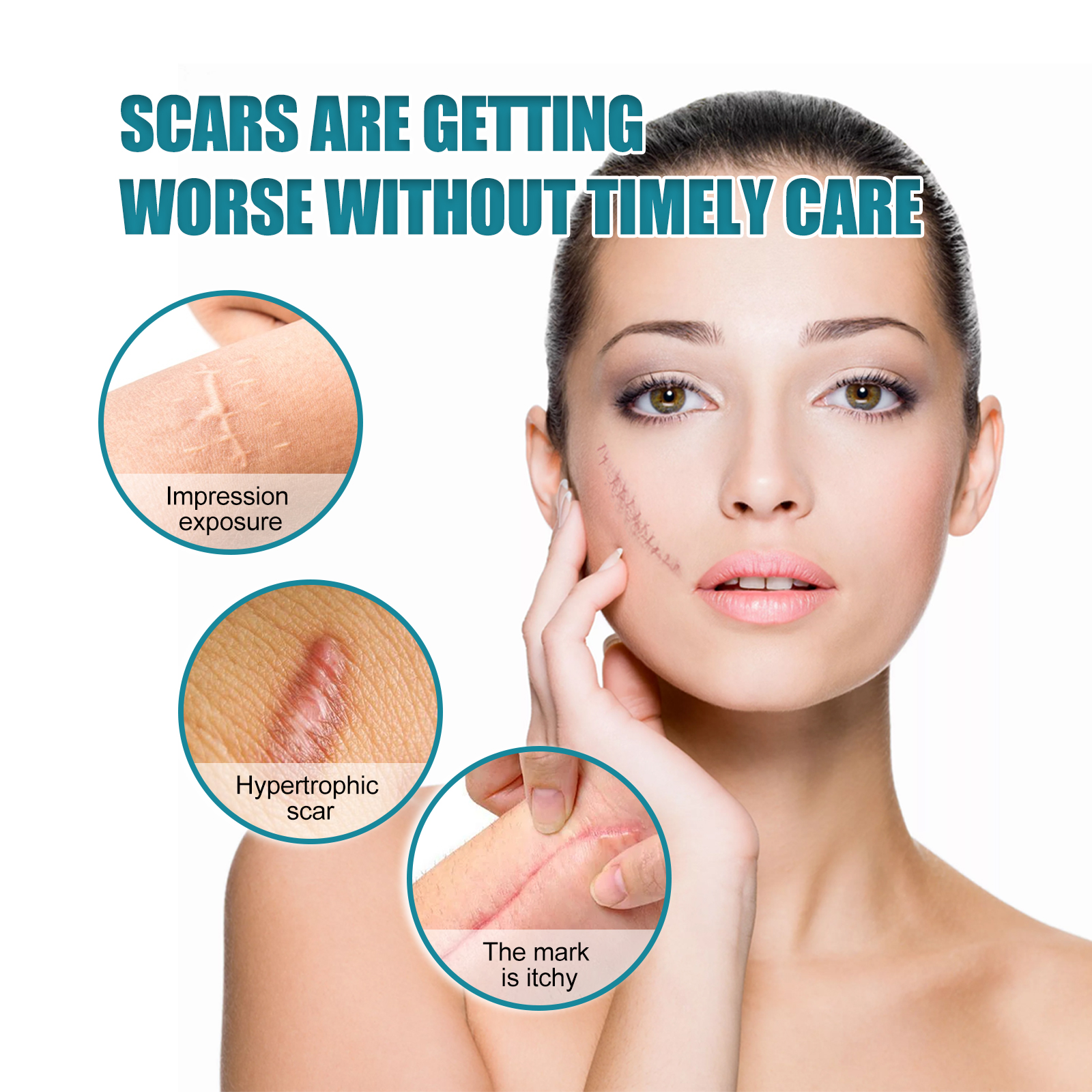 Silicone Scar Sheets Self-adhesive Beauty Stickers Surgical Scars ...