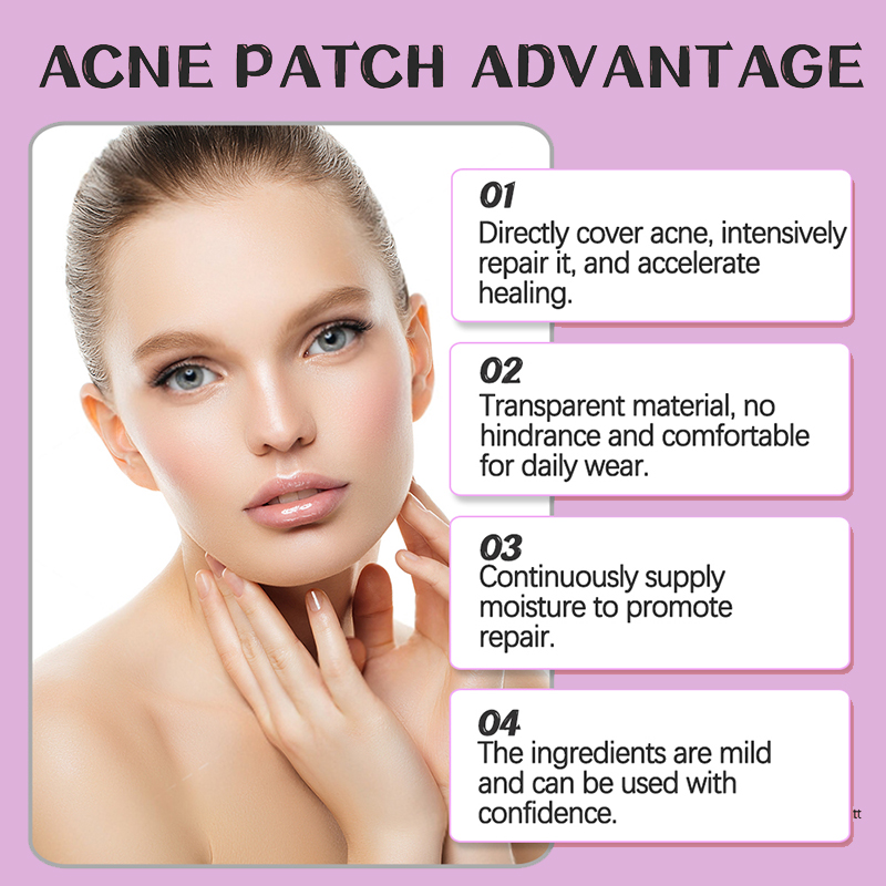 Acne patches for the face, hydrocolloid stickers for zits and blemishes ...