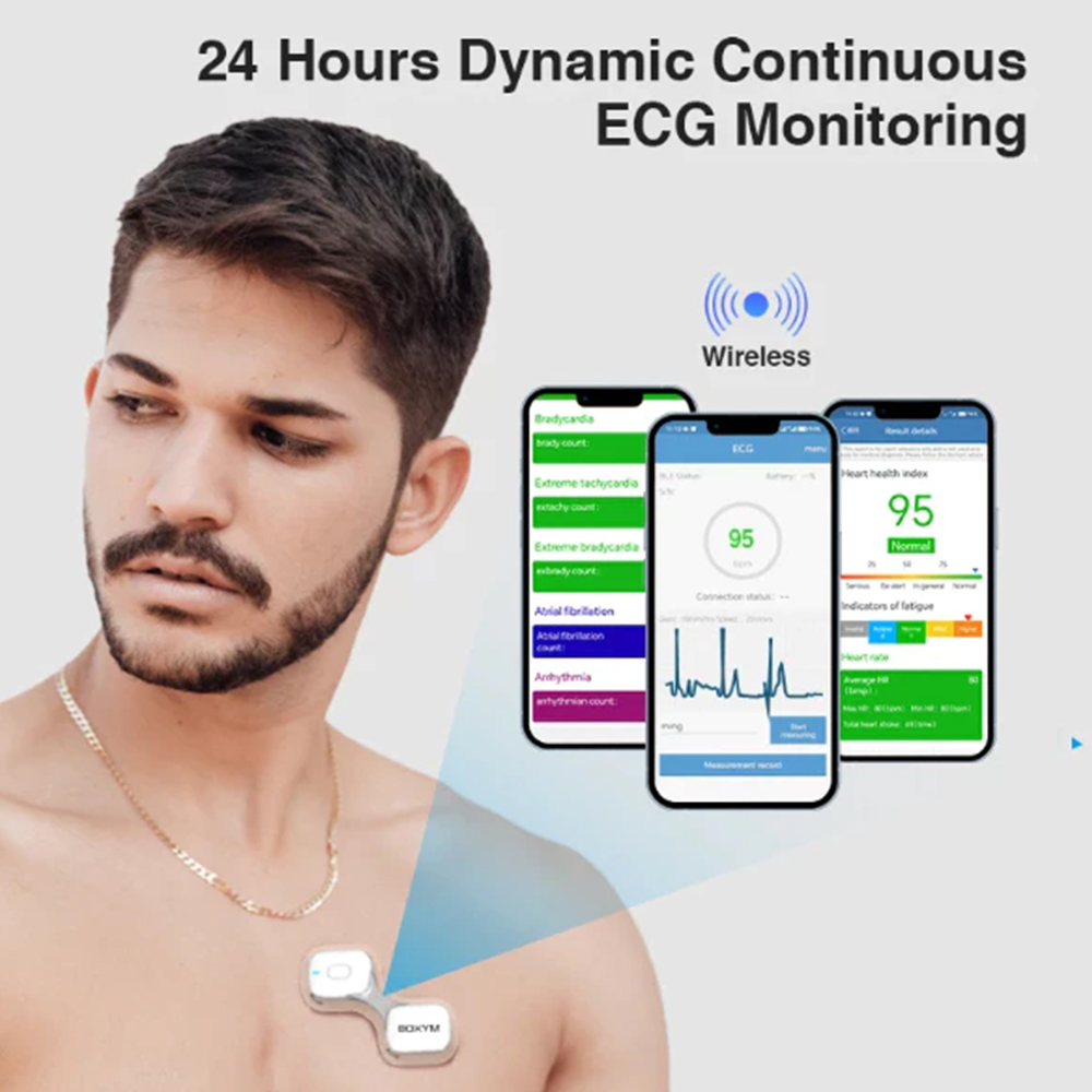 YONKER 36 Hour Heart Rate ECG EKG Bluetooth Charge Holter ECG Monitor ...