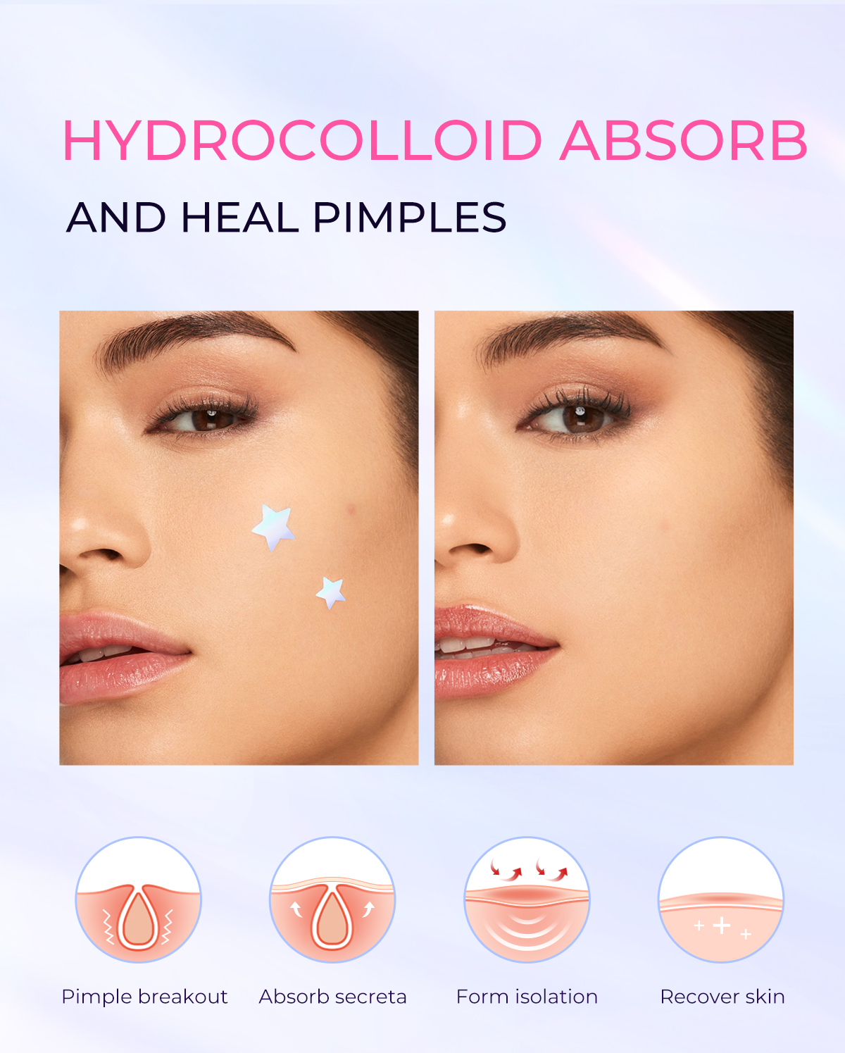 SACE LADY Salicylic Acid Pimple Patches Colorful Isolating Protection ...