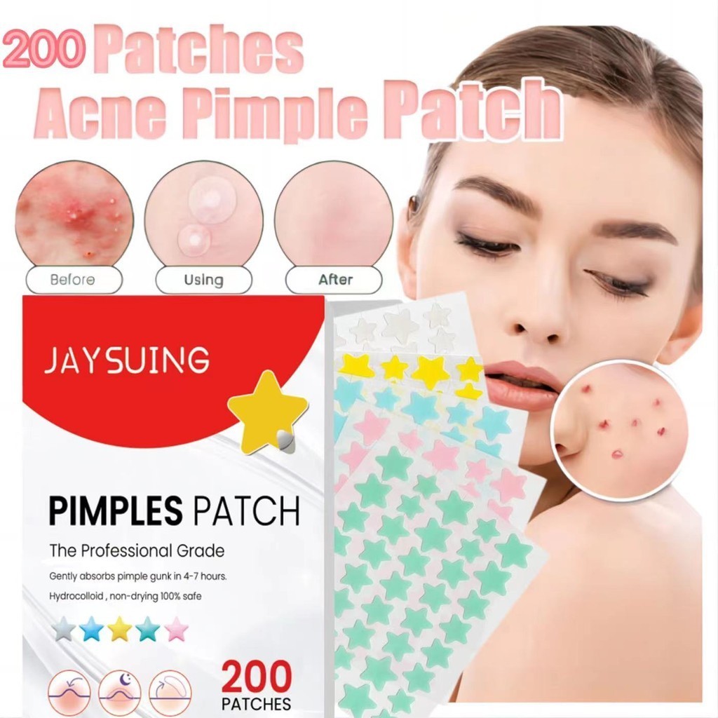 200 Colorful Star Pimple Patches for Face, Invisible Acne Removal ...