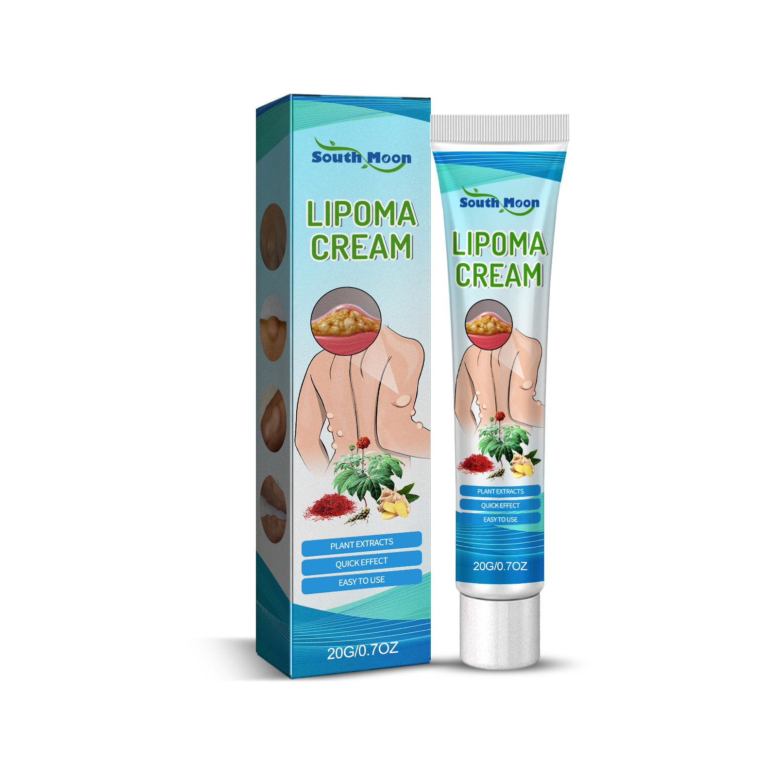 New Lipoma Removal Cream, Relieve Cream for Inflammation, Fibroids ...