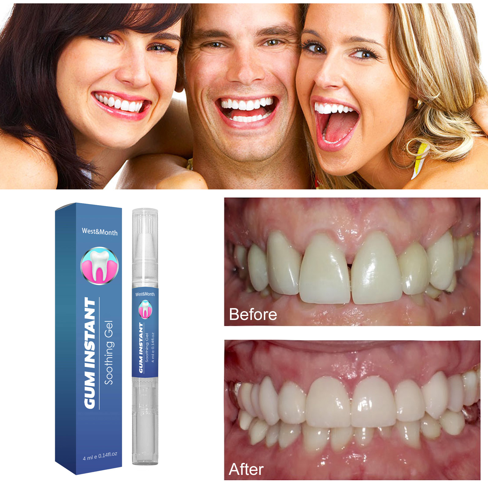 Gum Instant Soothing Gel Receding Gums Inflammation Gingival Care Gel ...
