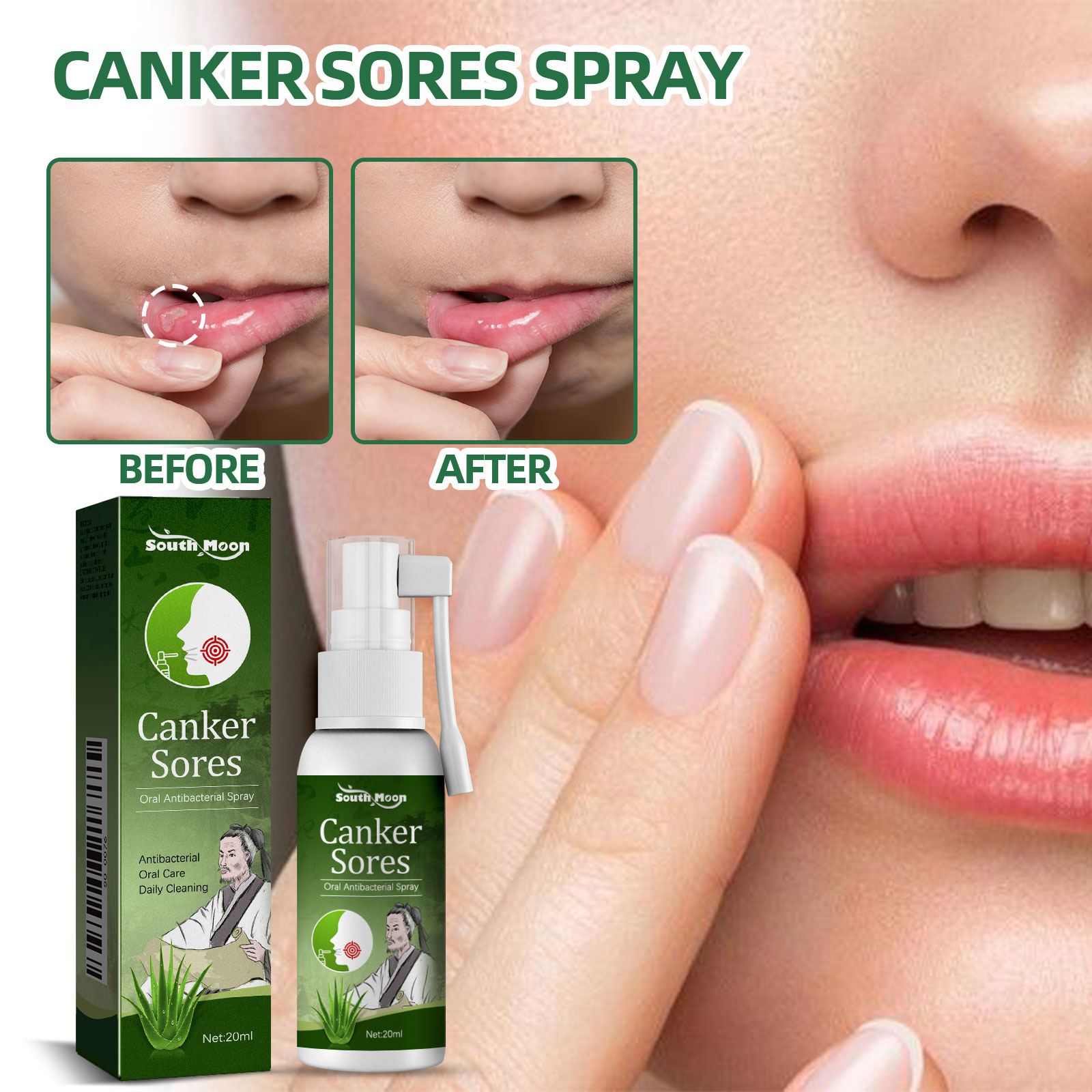 Natural Extract Antibacterial Mouth Spray for Oral Care, Ulcers ...