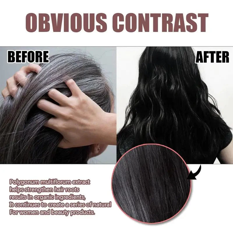 【BUY 1 TAKE 2】100g Hair Growth Soap with Polygonum Multiflorum to ...