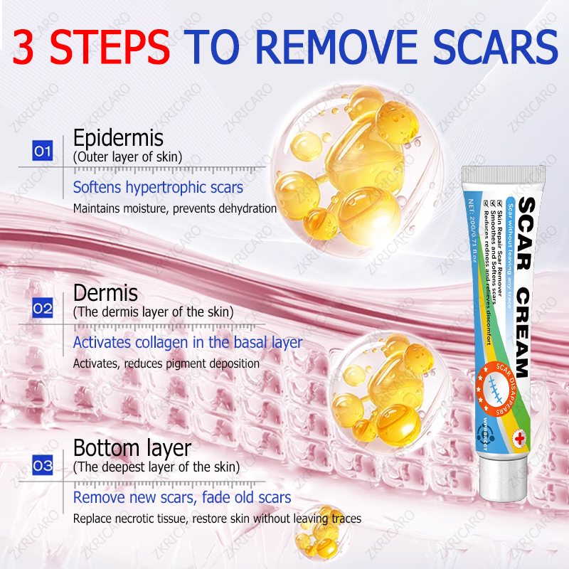Scar Removal Cream,Advanced Scar Cream for Surgical Scars, Acne Scars ...