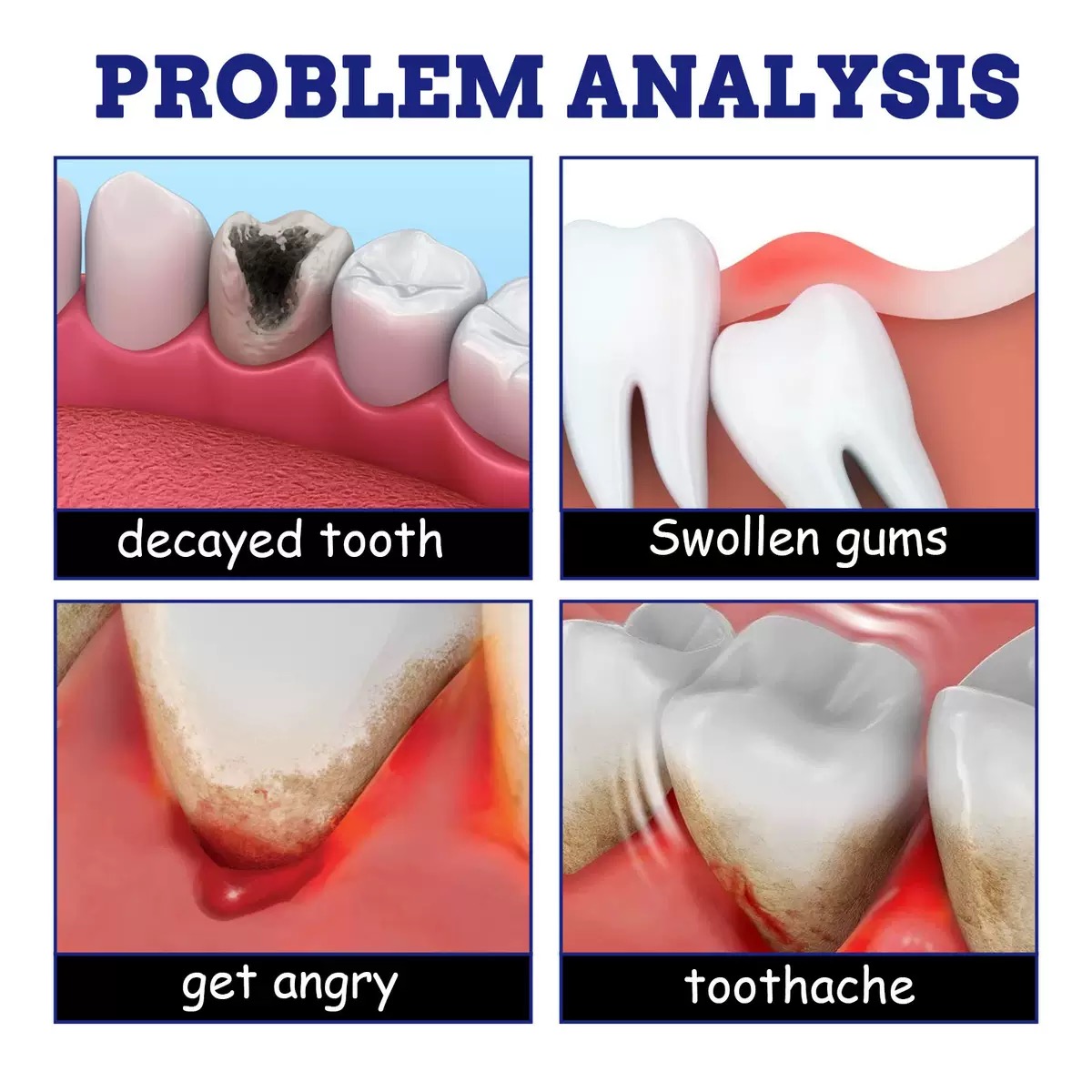 New Oral Care Toothache Spray 20ml, Antibacterial Relief for ...