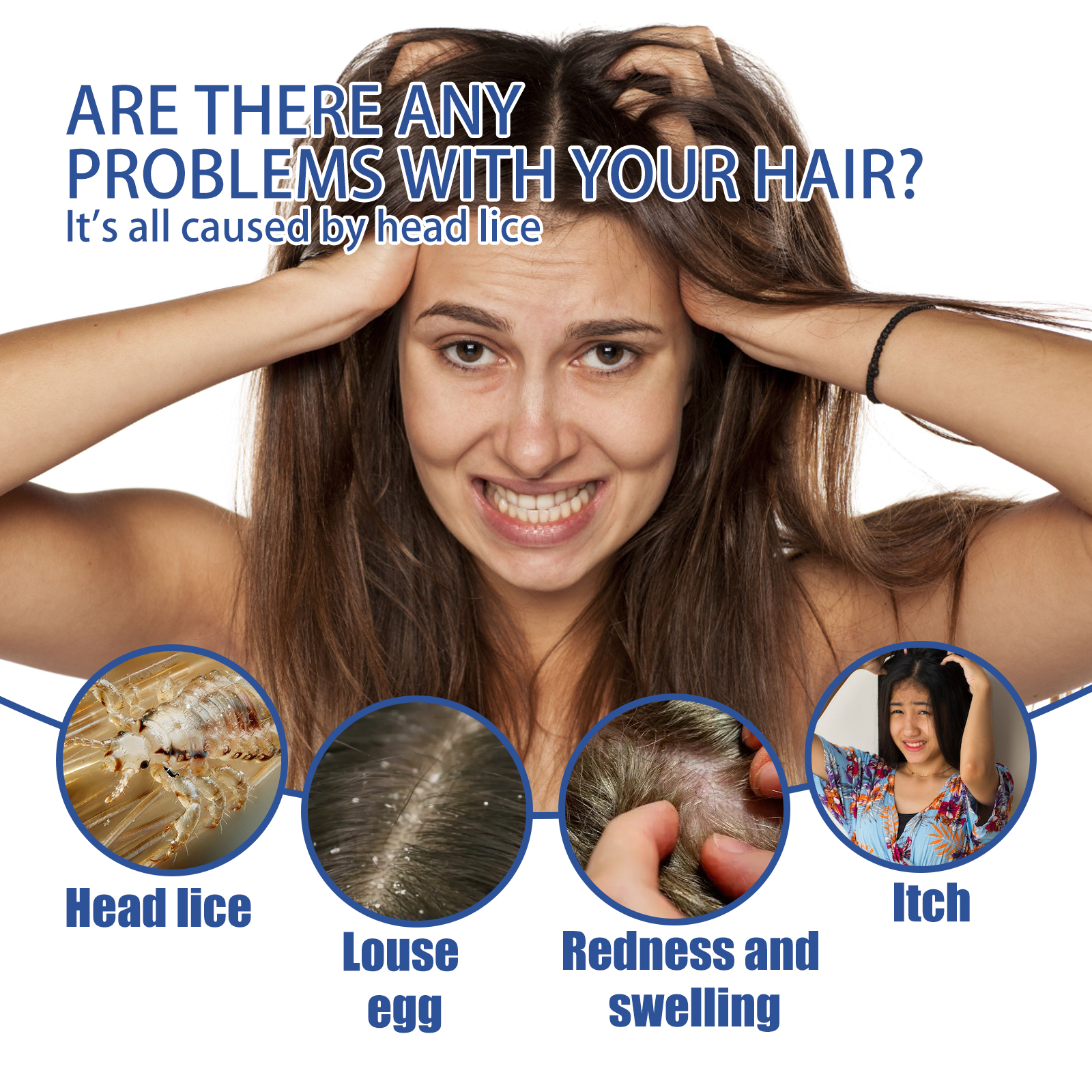 South Moon Scabies and Lice Spray Eradicates Head Lice, Pubic Lice ...