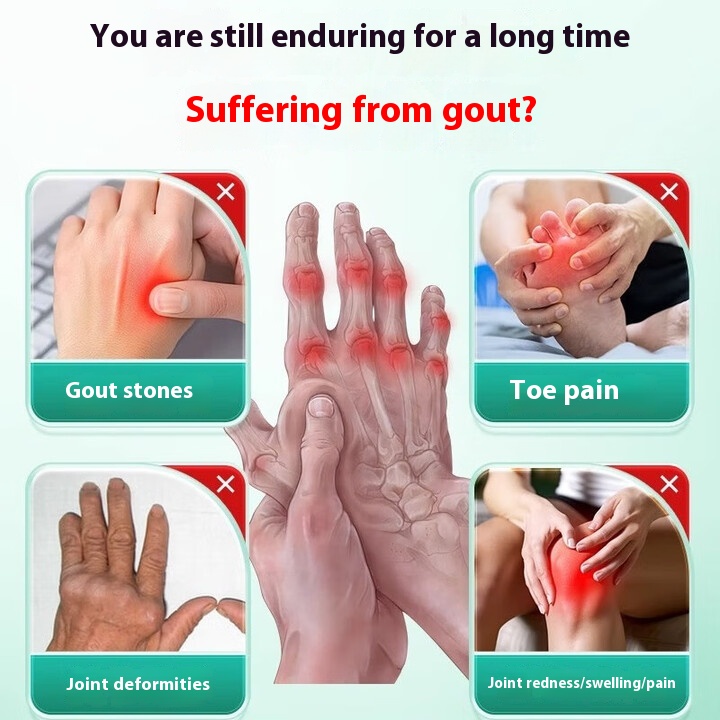[6 pcs/box] Gout patch Gout patch toe joint neckshoulder pain knee swelling pain plaster ...