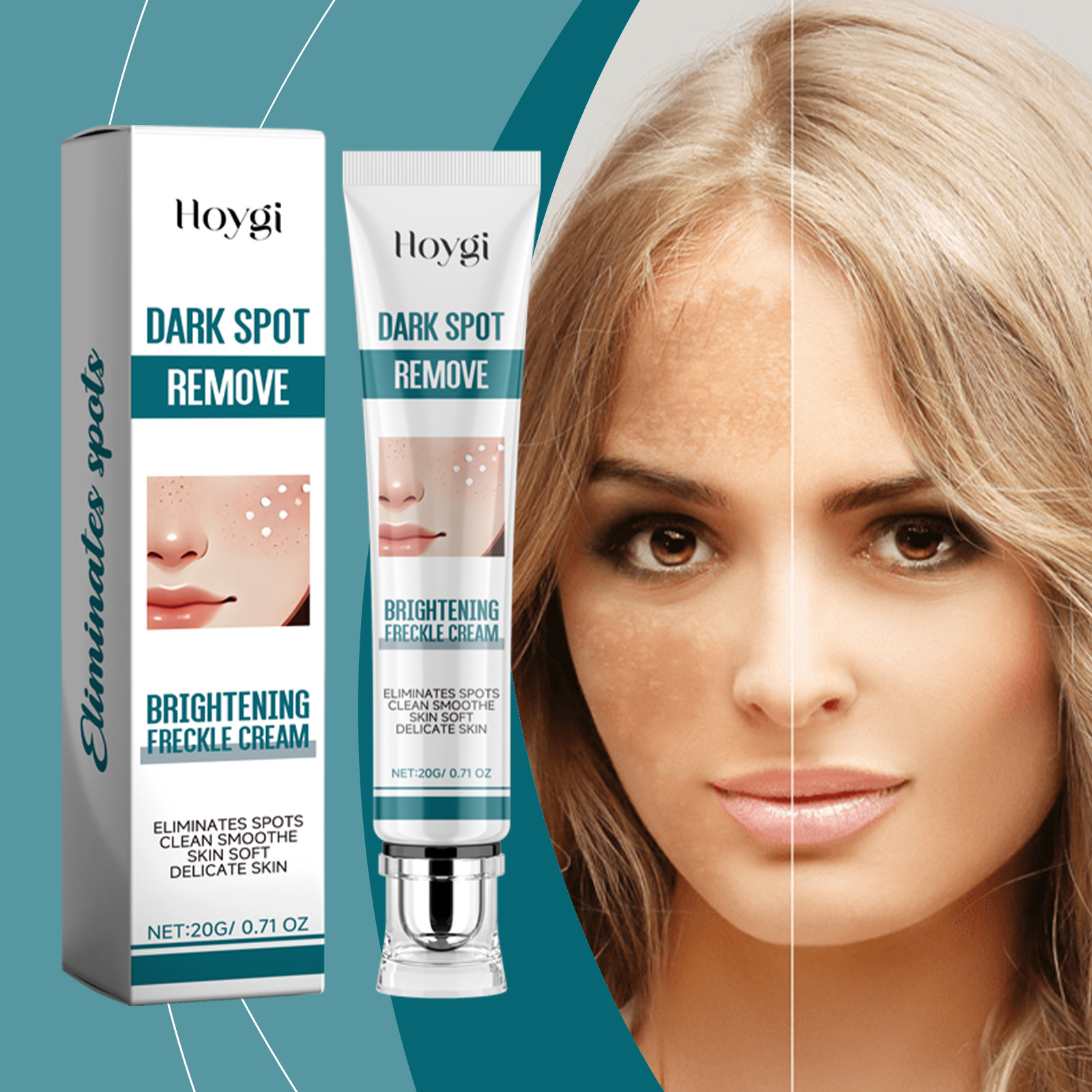 Original Dark Spot Remover Cream for Face Melasma Pekas Treatment ...