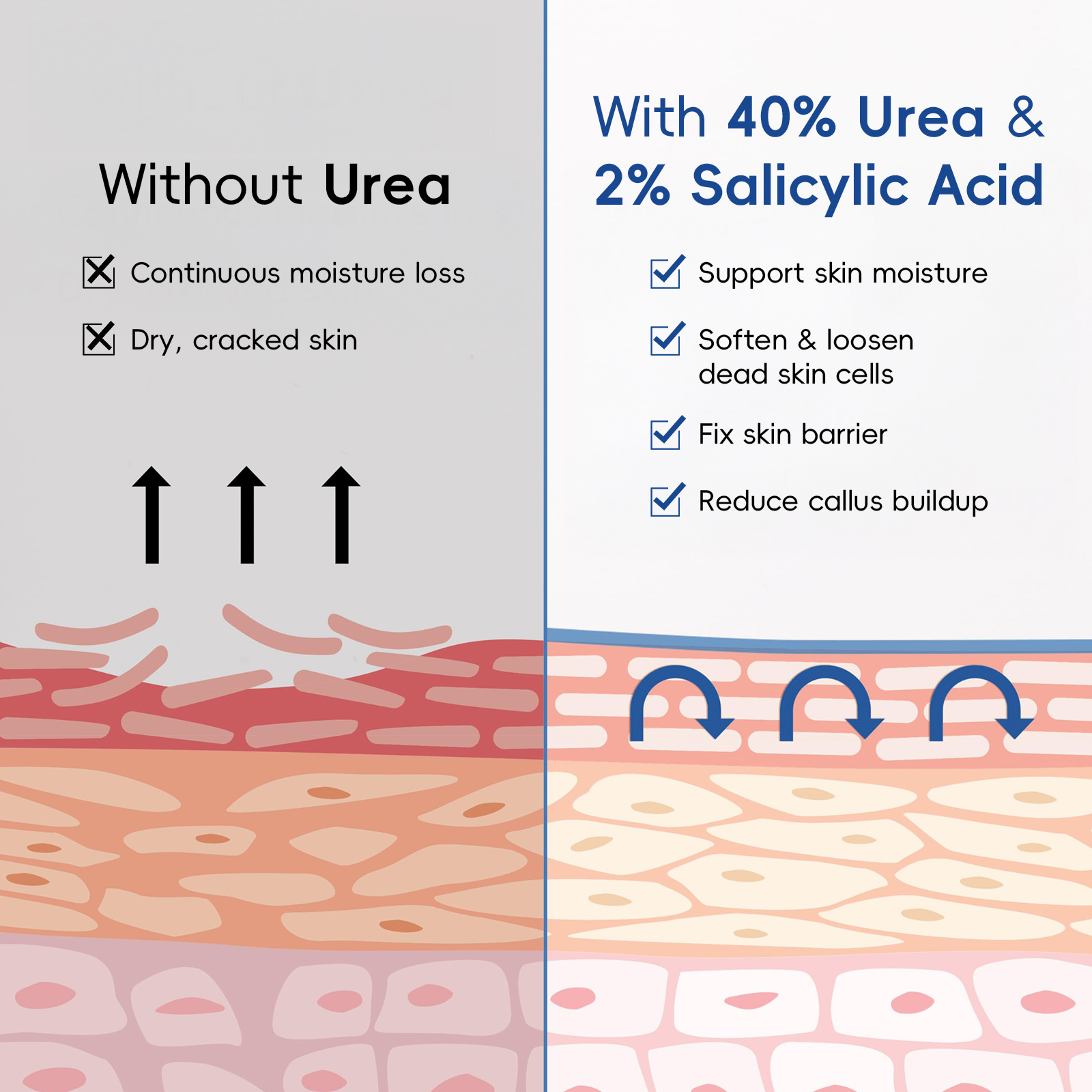 QUIYUM 40% Urea Cream 100g Intensively Moisturize For Body&Foot ...