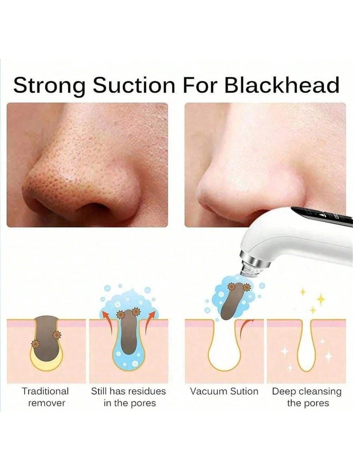 Top-tier blackhead extractor featuring 6 suction nozzles. Compact ...
