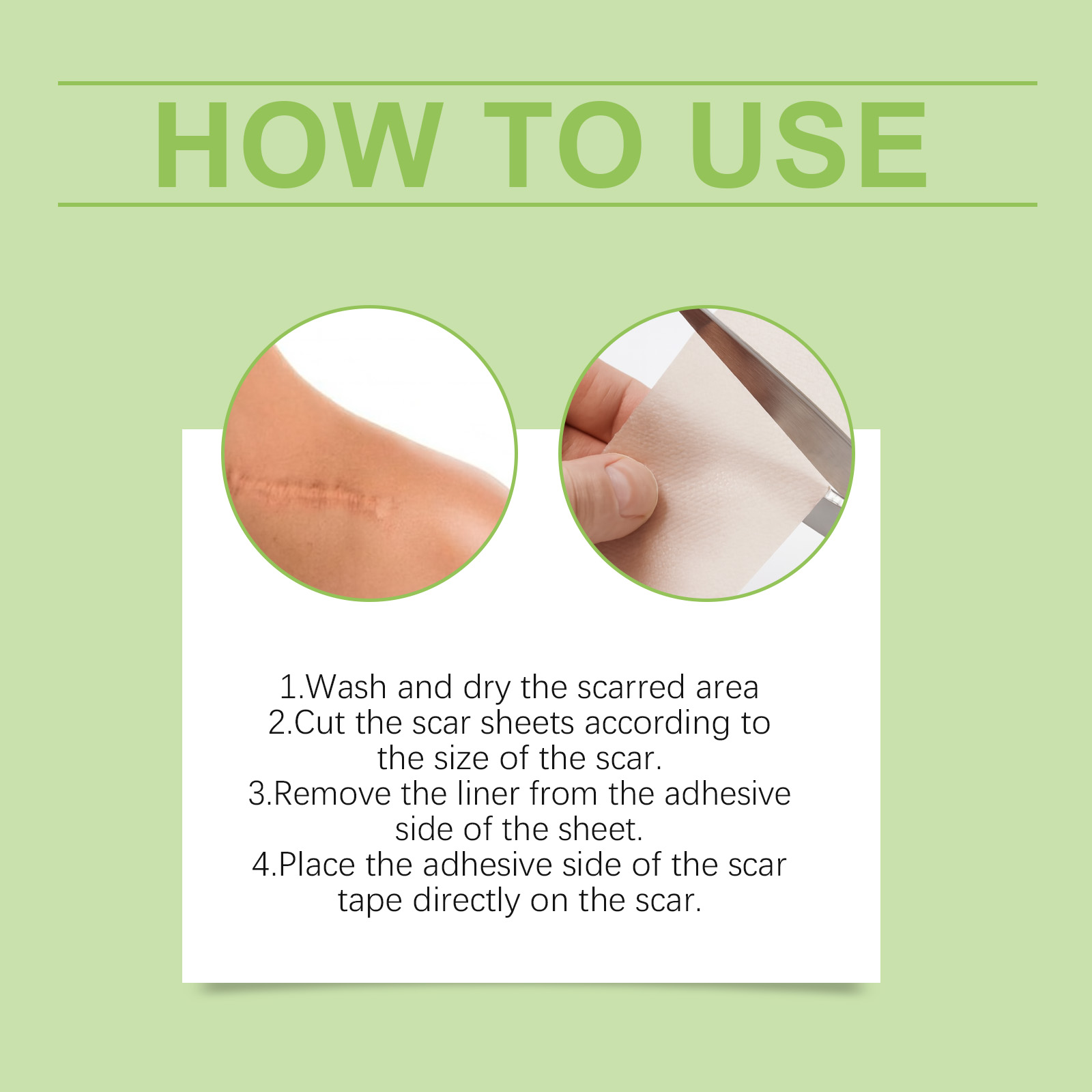 Silicone Scar Patch for Lightening Surgical, Acne, and Burn Scars 150cm ...