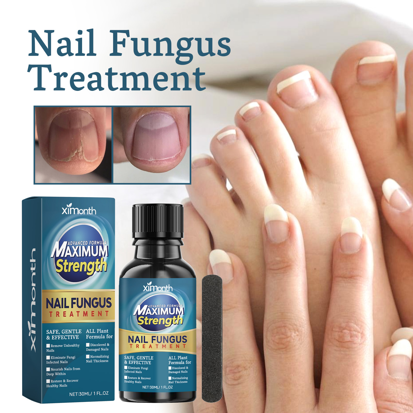 Superior Nail Fungus Remedy - 30ML Treatment for Toenails & Fingernails ...