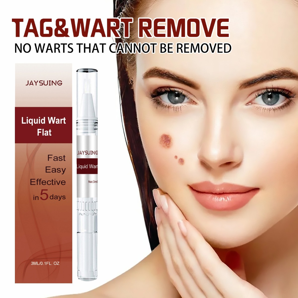 Moles and Skin Tags Removal Liquid Pen Against Papillomas, Warts, and ...