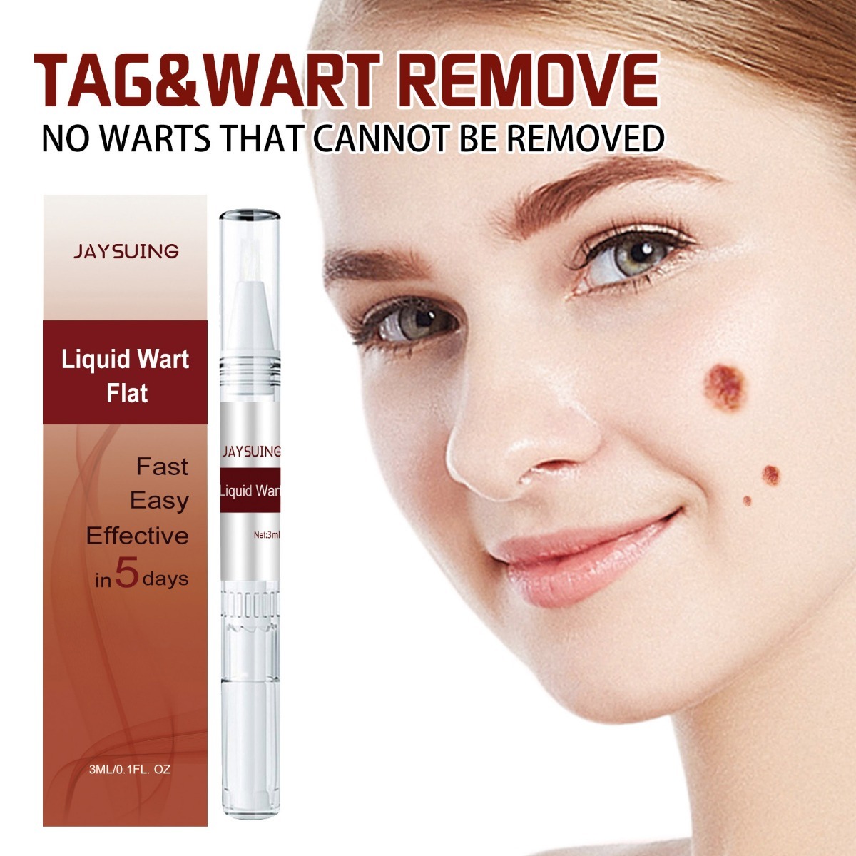 Moles and Skin Tags Removal Liquid Pen Against Papillomas, Warts, and ...