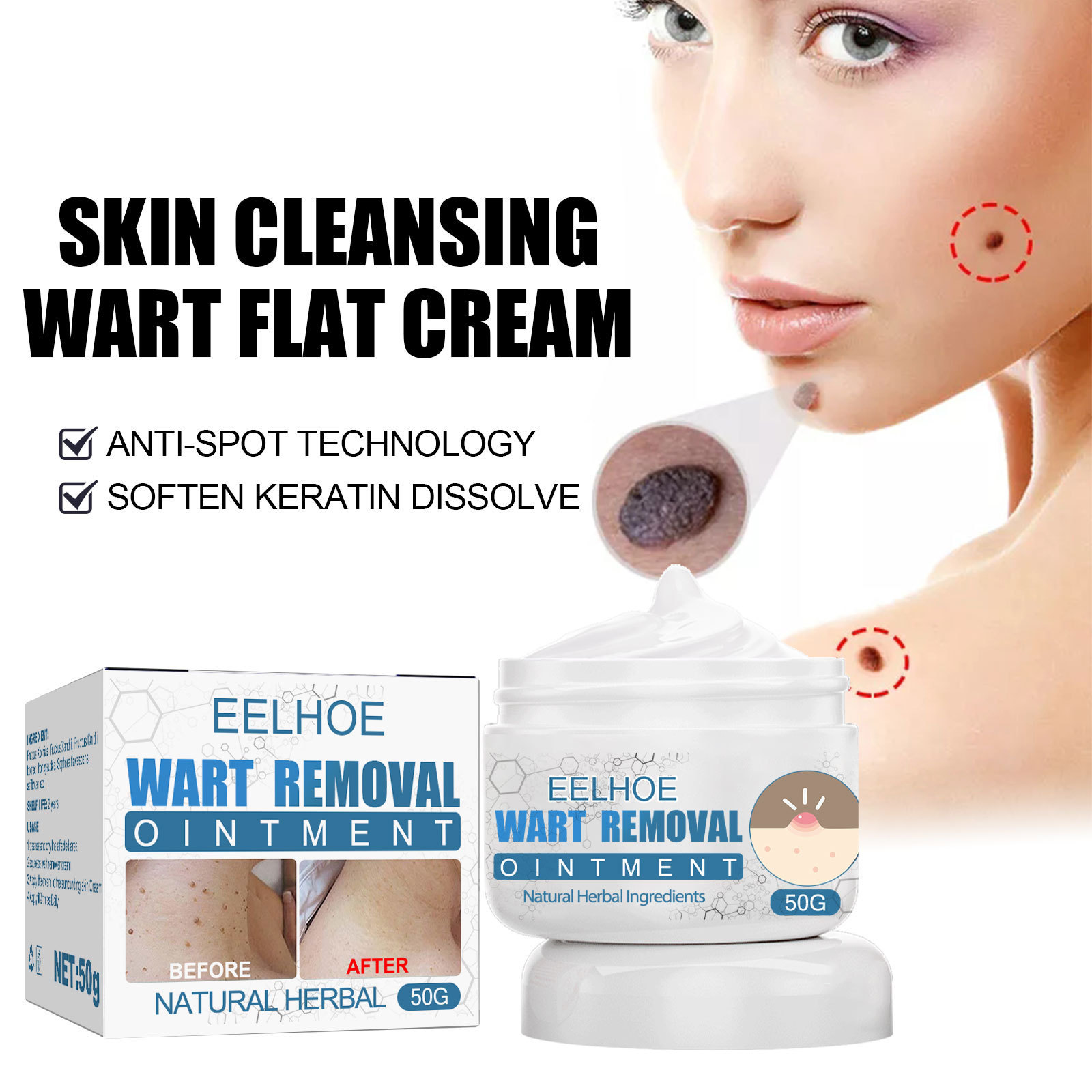 Fast Relief Wart & Tag Cream, 50g Ointment for Wart Removal | Shopee ...