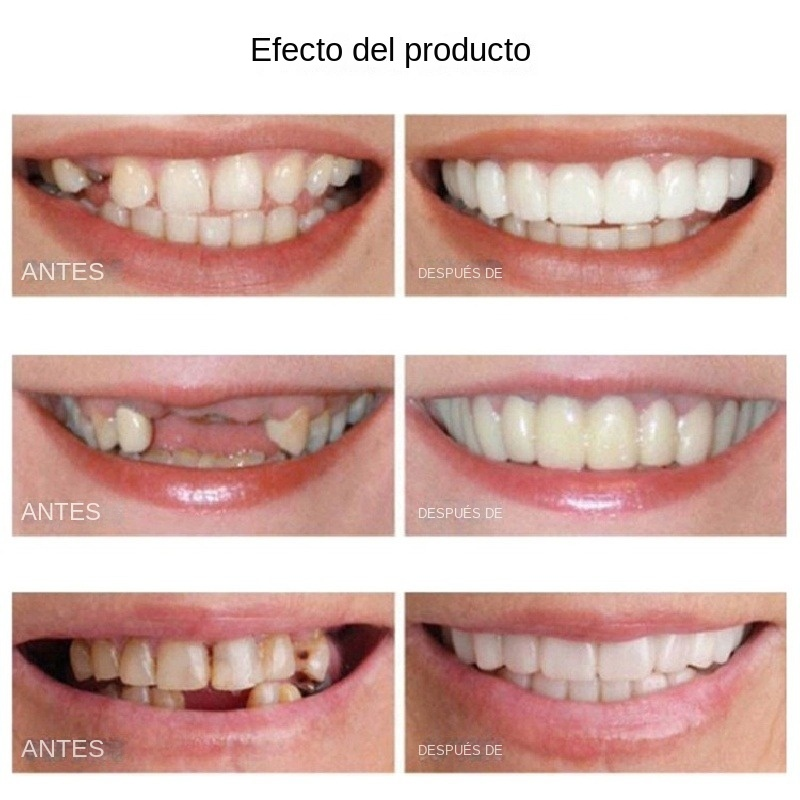 Removable Masks with Upper and Lower Pressure Closure | Shopee Philippines