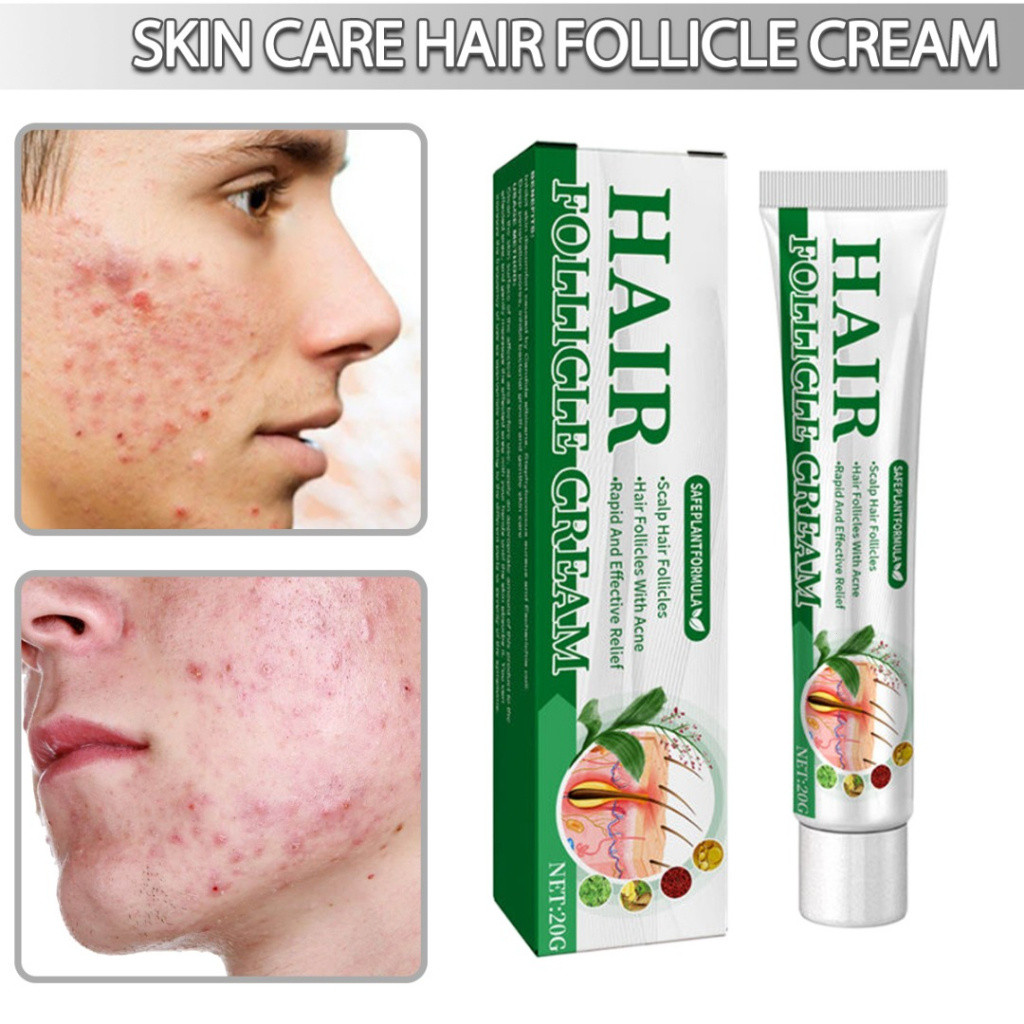 hair follicle cream, used to relieve folliculitis, relieve itching on ...