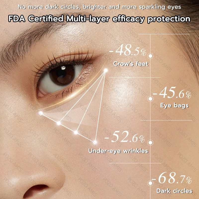 Eye repair cream Eyebags Remover Cream Eye Care For Dark Circles Anti ...