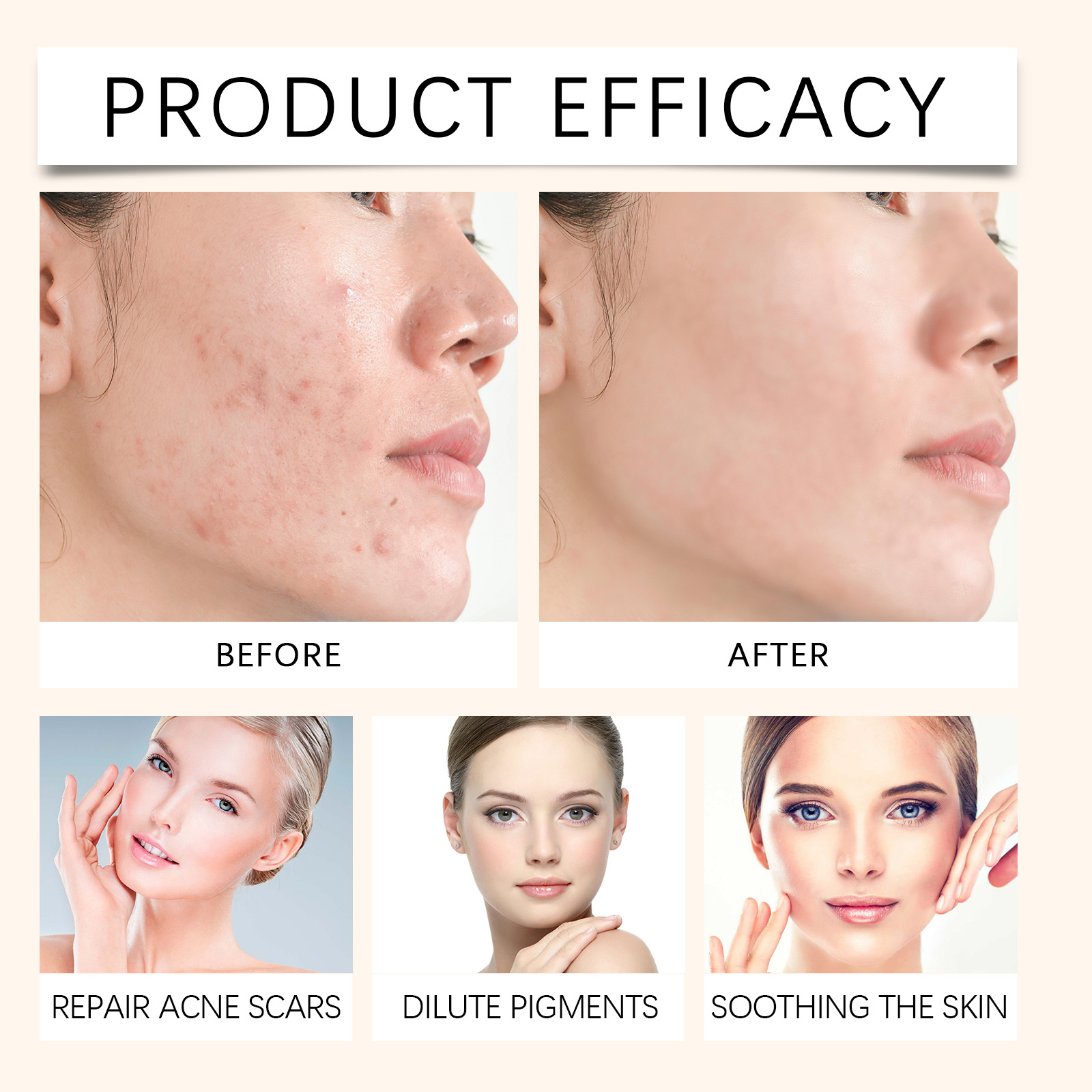 EELHOE Oily Skin Moisturizing Balm Gentle Herbal Care Acne-Prone Facial ...