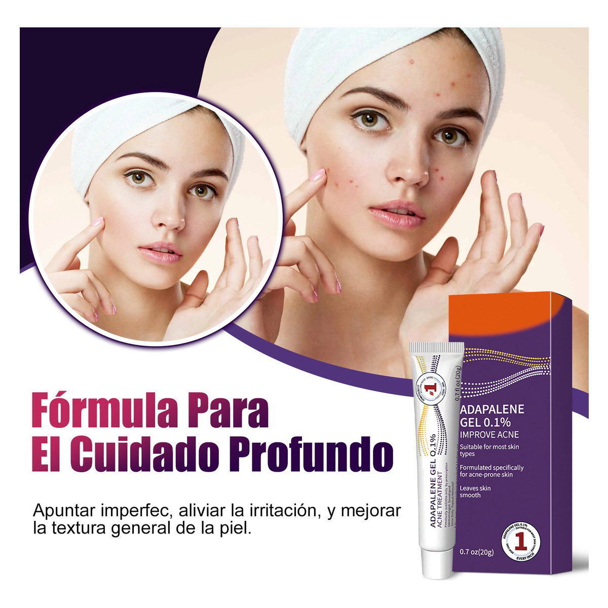 Anti-Acne Adapalene Gel 0.1% - Smooths Skin Texture, Formulated for ...