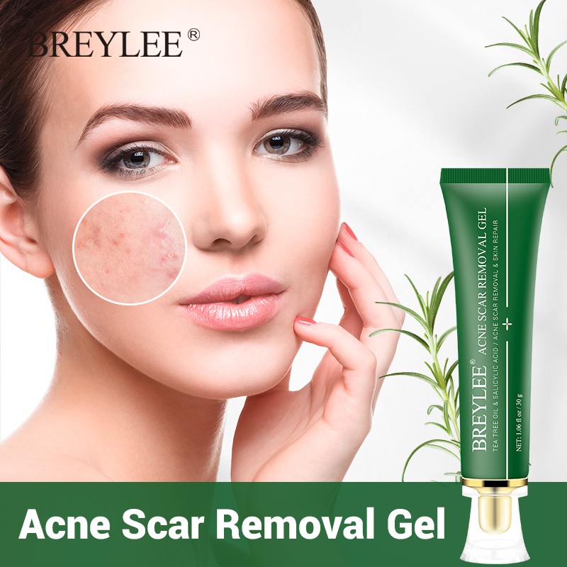 BREYLEE Acne Scars Repair Gel Anti Acne Scars Fade Stretch Marks Skin ...