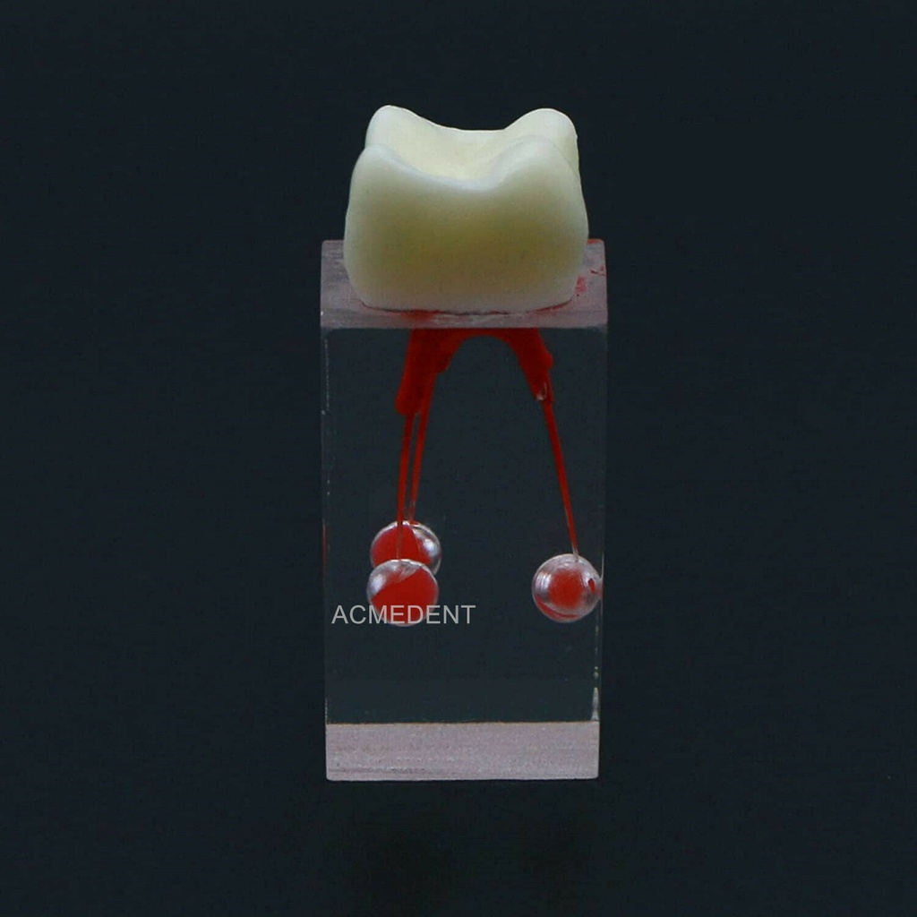 3Type Dental Model Endodontic Root Canal Block Practice Pulp Crown ...