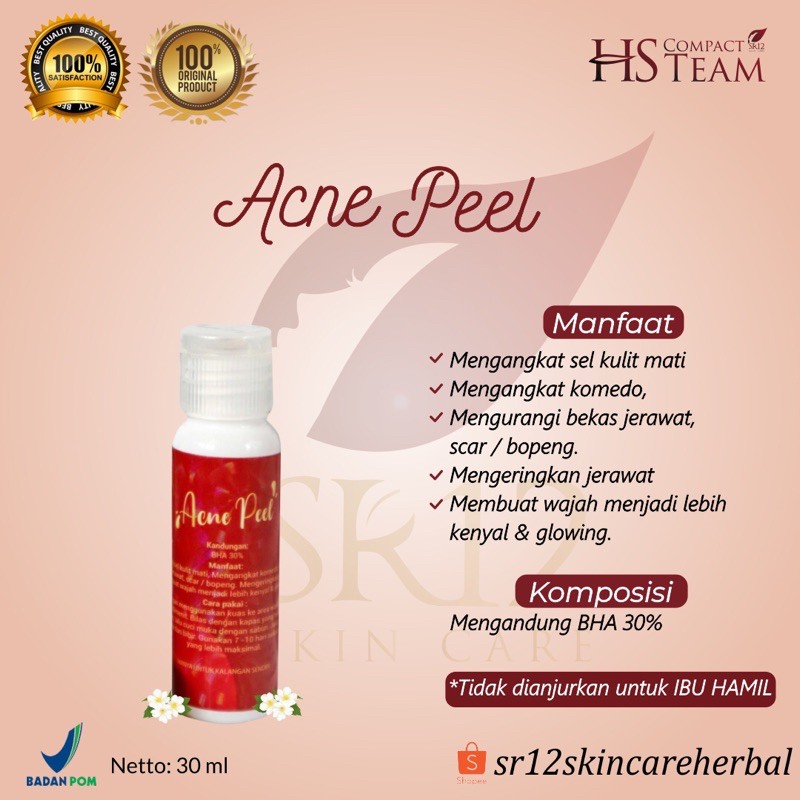 Acne Peel Sr12 / Acne Solution, Scar / Bopeng, Blackheads, Glowing ...