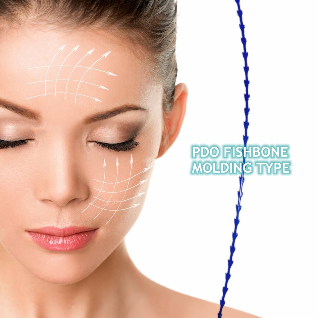 20pcs PDO PCL PLLA Korea Mono Tornado Screw Barbed Cog 4D Sharp Needle Polidioxanona Hilos ...