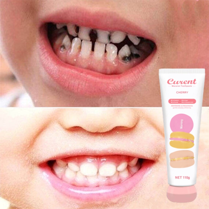 Whitening Toothpaste pampaputi ng ngipin Remove Plaque Stain Anti-decay ...