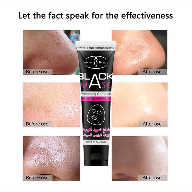 Blackhead removal cream to remove blackheads and whiteheads pore ...